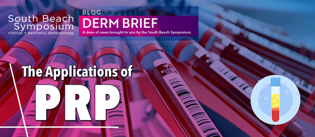 The Applications of PRP - LiVDerm
