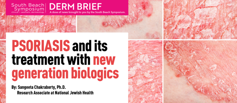 Psoriasis and Its Treatment with New Generation Biologics - LiVDerm