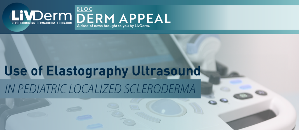 Use of Elastography Ultrasound in Pediatric Localized Scleroderma - LiVDerm