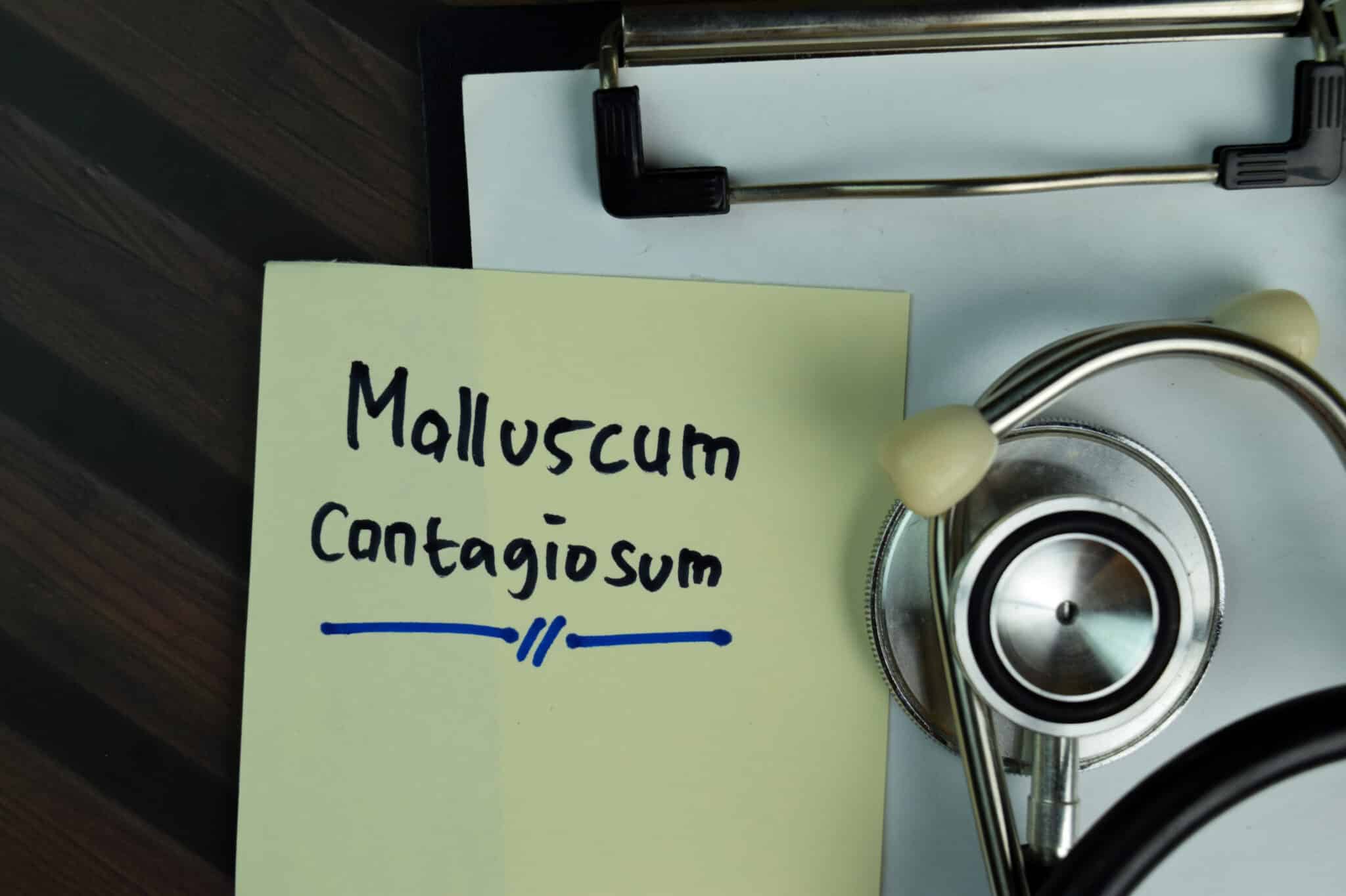 ZELSUVMI is First Prescription Medication for At-home Use In Treating ...