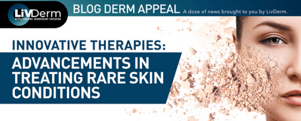 Innovative Therapies: Advancements in Treating Rare Skin Conditions ...
