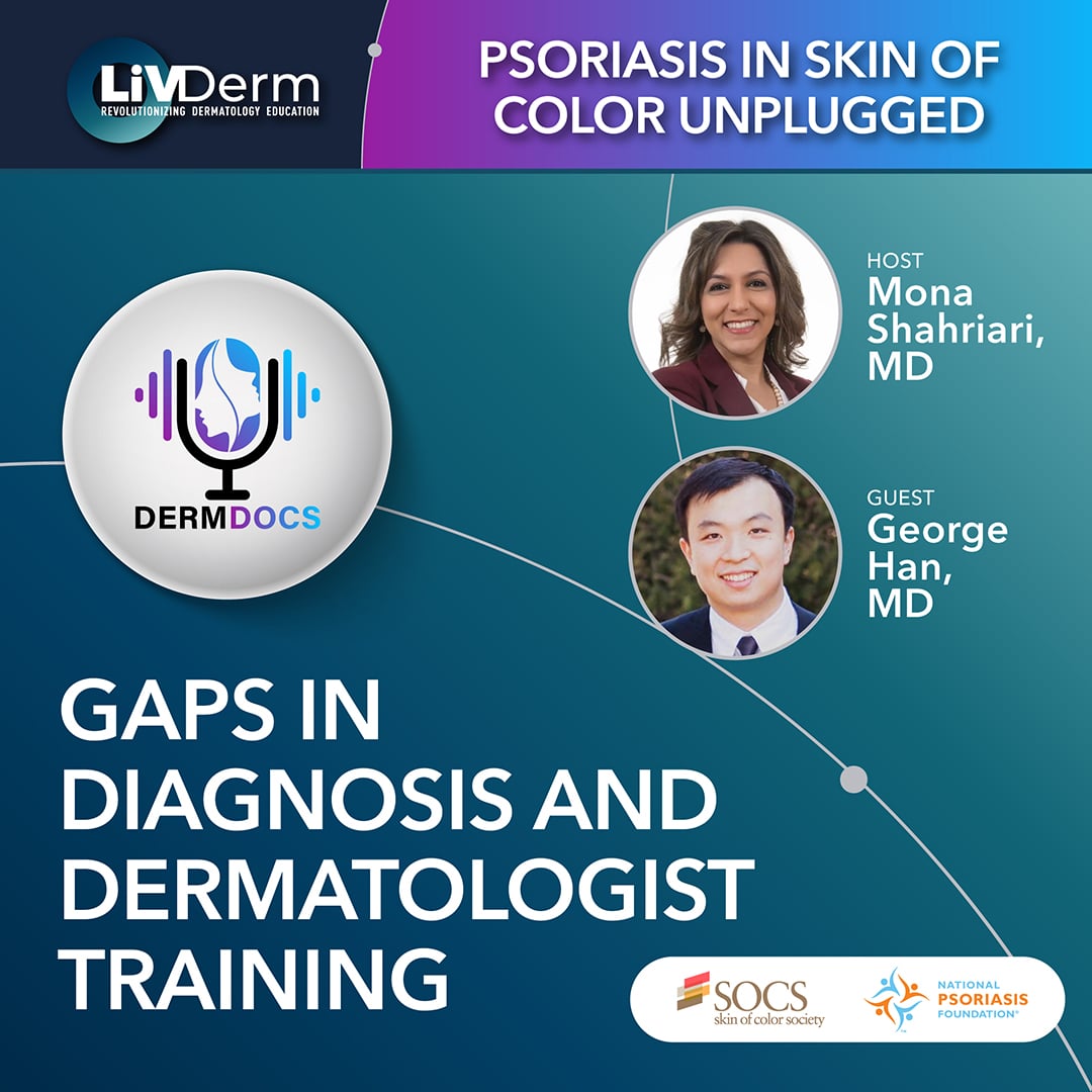 Psoriasis in Skin of Color Unplugged: Gaps in Diagnosis and Dermatologist Training - LiVDerm