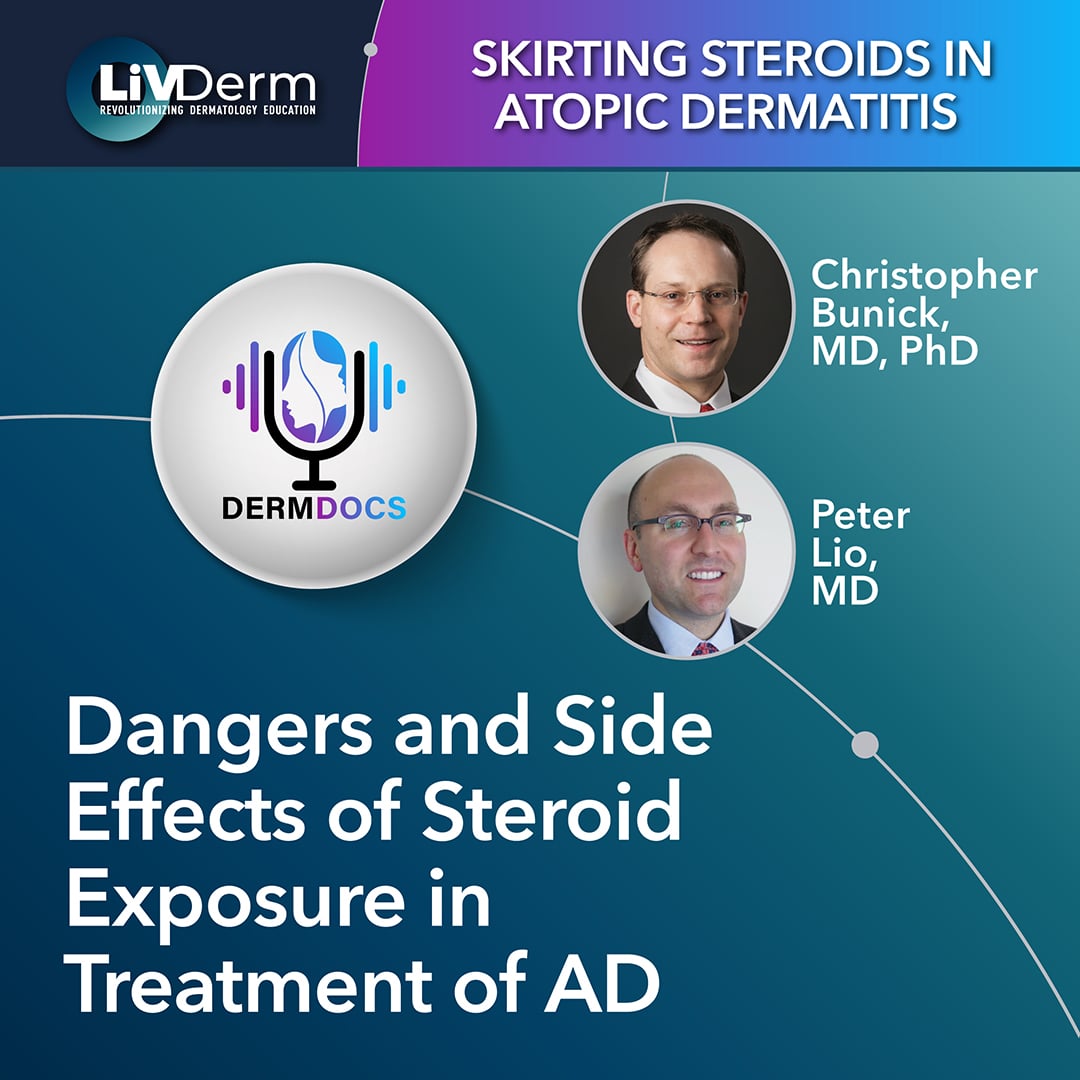 Skirting Steroids in Atopic Dermatitis: Dangers and Side Effects of ...