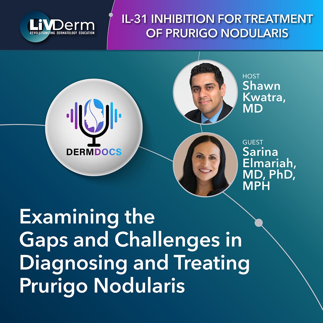 Examining the Gaps and Challenges in Diagnosing and Treating Prurigo ...