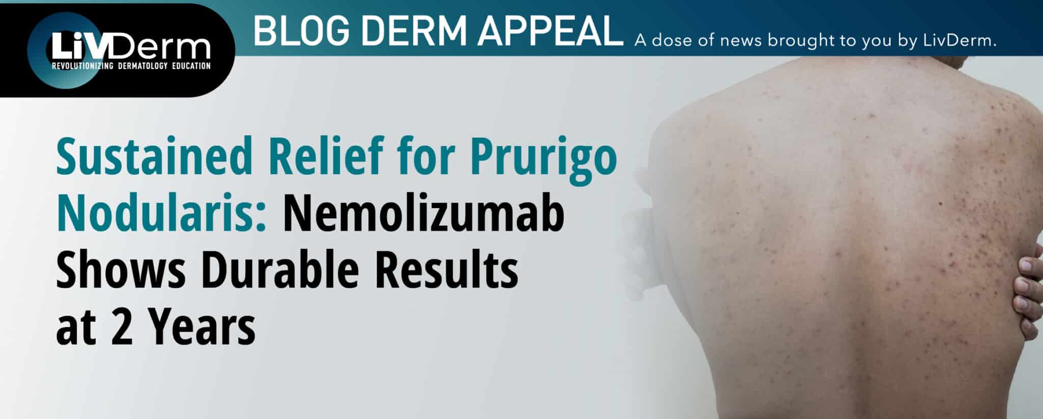 Sustained Relief for Prurigo Nodularis: Nemolizumab Shows Durable ...
