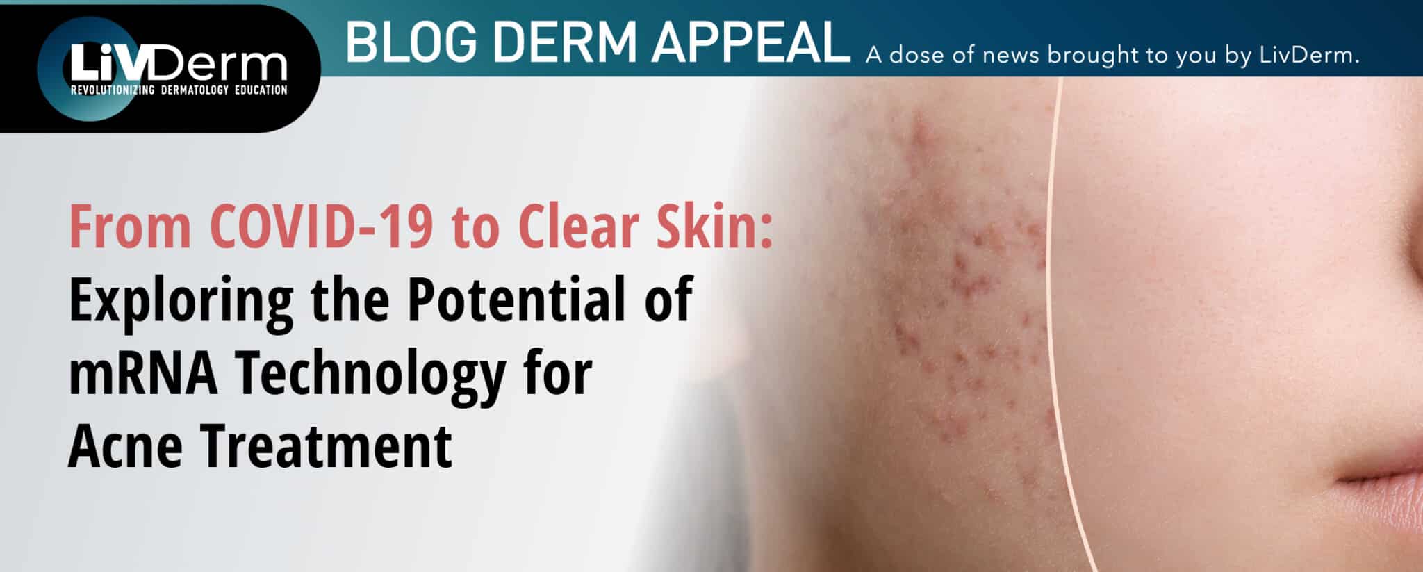 FDA Approves Galderma’s Nemluvio® (nemolizumab) for Prurigo Nodularis ...