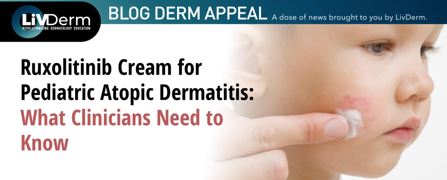 Ruxolitinib Cream for Pediatric Atopic Dermatitis: What Clinicians Need ...