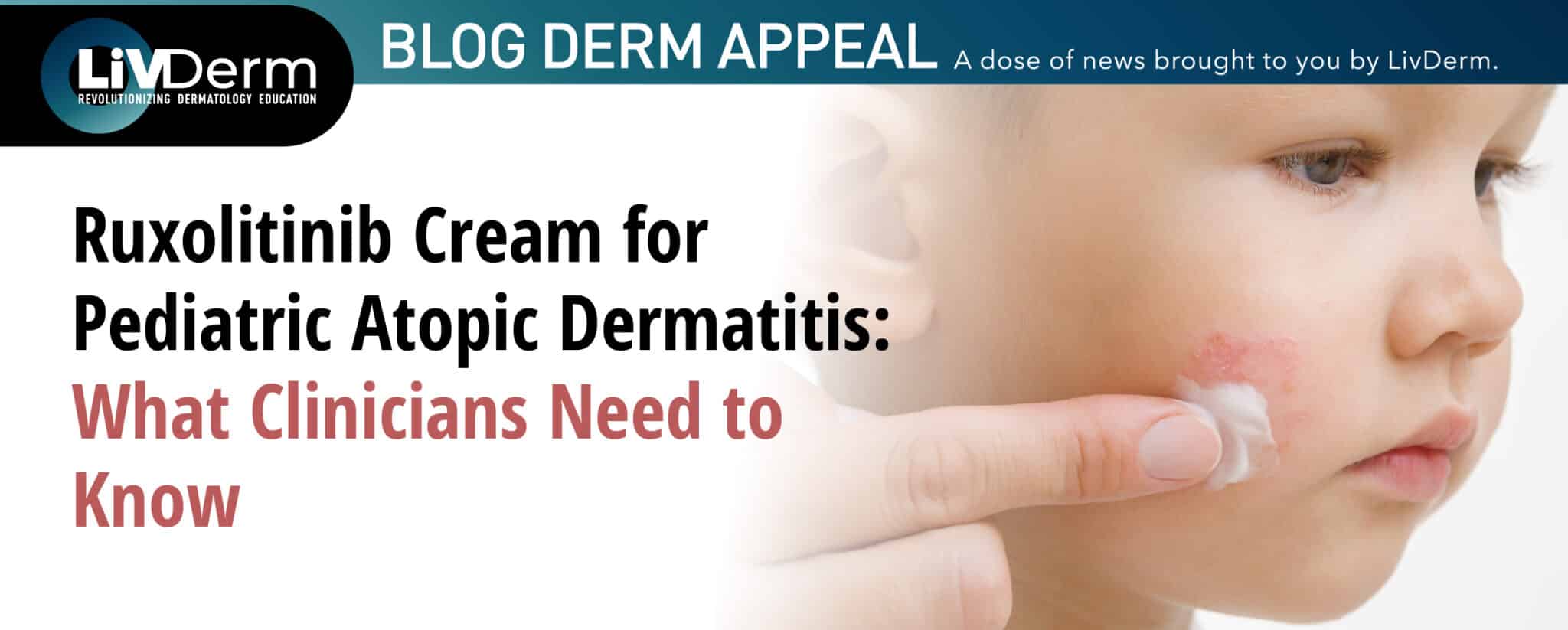 Ruxolitinib Cream for Pediatric Atopic Dermatitis: What Clinicians Need ...